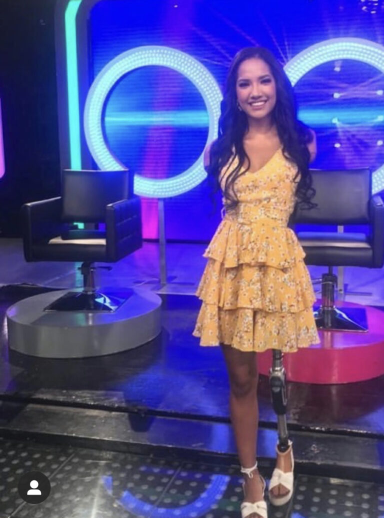 Victoria Salcedo perdió tres de sus extremidades en su niñez. Hoy sueña ...