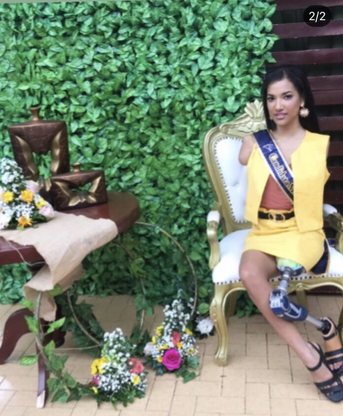 Victoria Salcedo perdió tres de sus extremidades en su niñez. Hoy sueña ...