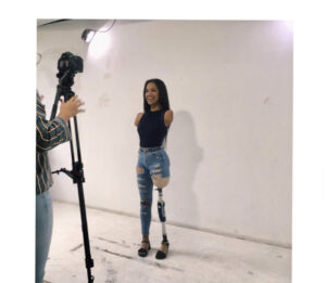 Victoria Salcedo perdió tres de sus extremidades en su niñez. Hoy sueña ...