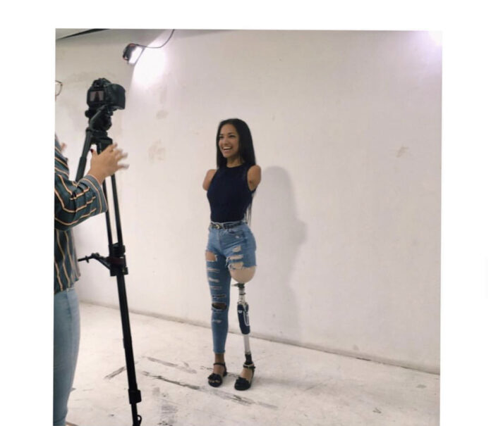 Victoria Salcedo perdió tres de sus extremidades en su niñez. Hoy sueña ...