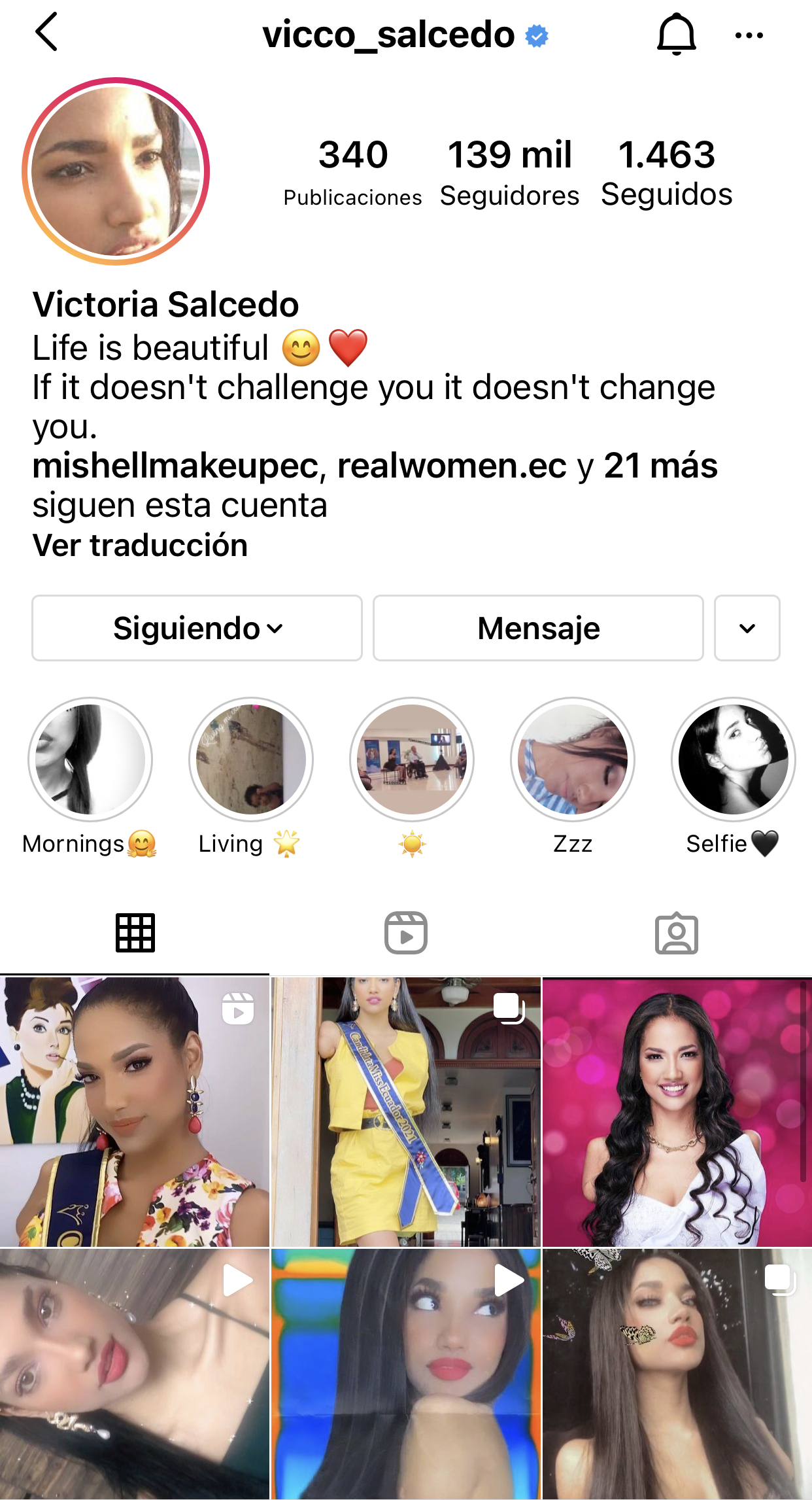 Victoria Salcedo perdió tres de sus extremidades en su niñez. Hoy sueña ...